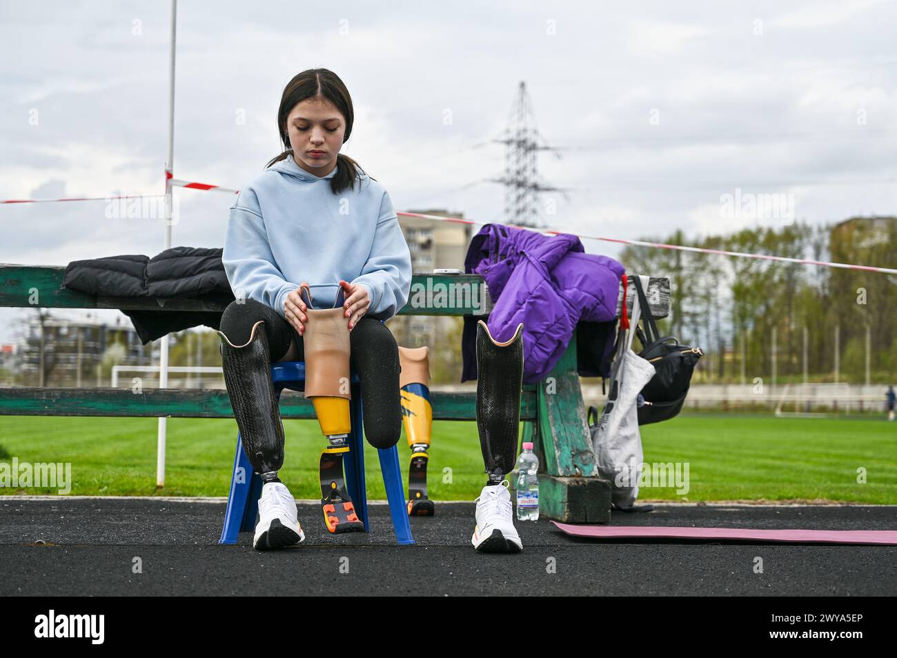 Non Exclusive: LVIV, UKRAINE - APRIL 04, 2024 - A 12-year-old Ukrainian ...