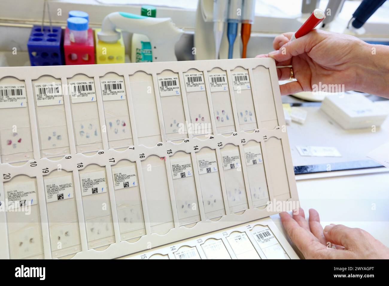 zebrafish samples, Slides stained with immunohistochemistry technique ...