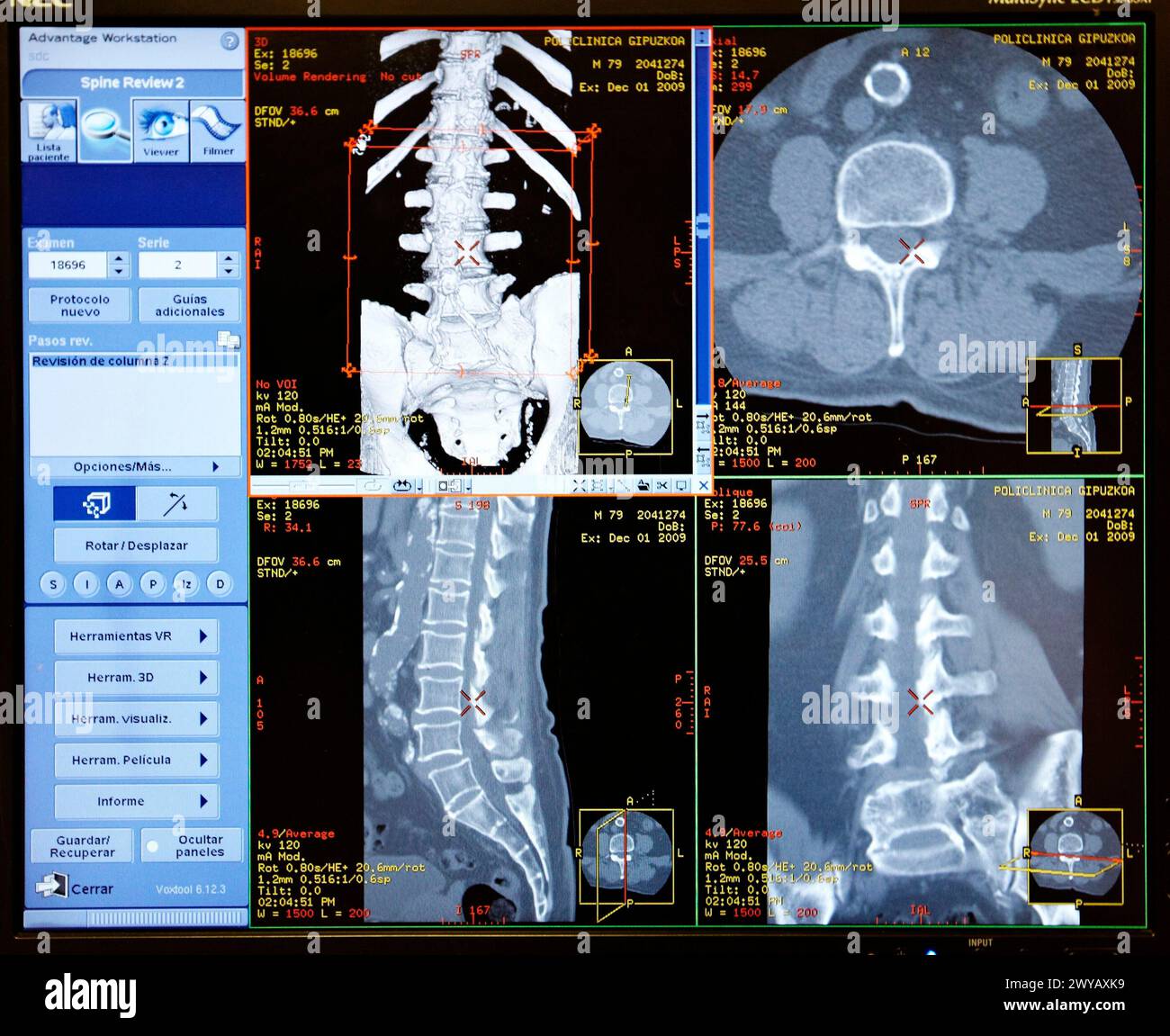 Hd scan hi-res stock photography and images - Alamy