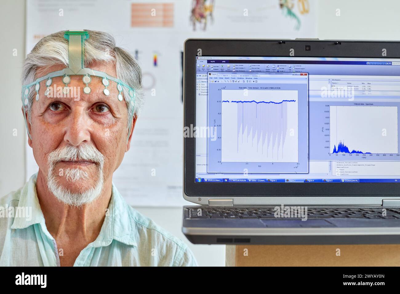 Neuromodulation system in closed loop hi-res stock photography and ...