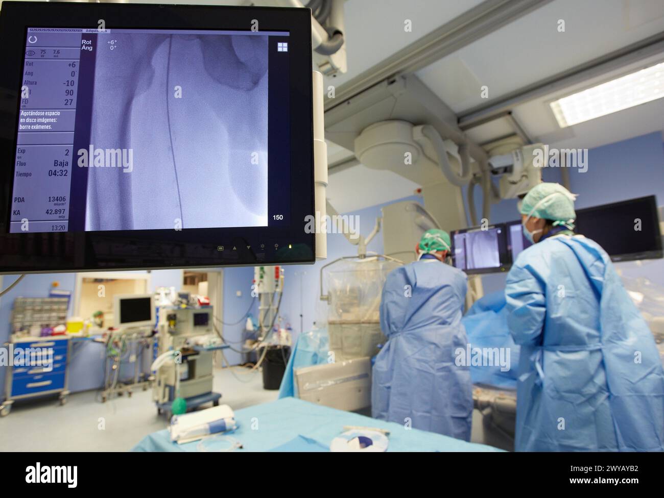 Angioplasty distal hi-res stock photography and images - Alamy
