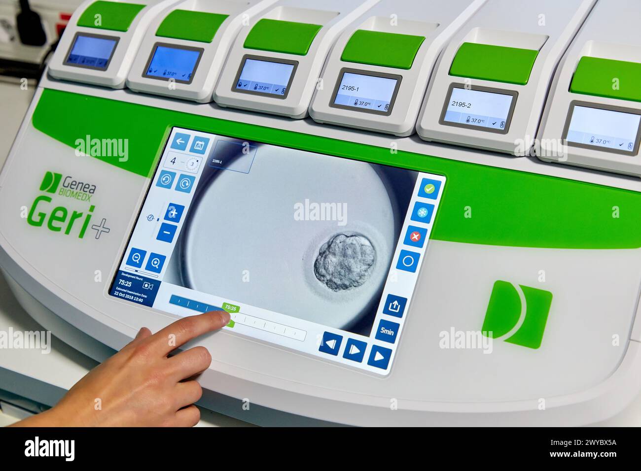 Geri +, EEVA System, Embryo Early Viability Assessment Test, Embryology ...