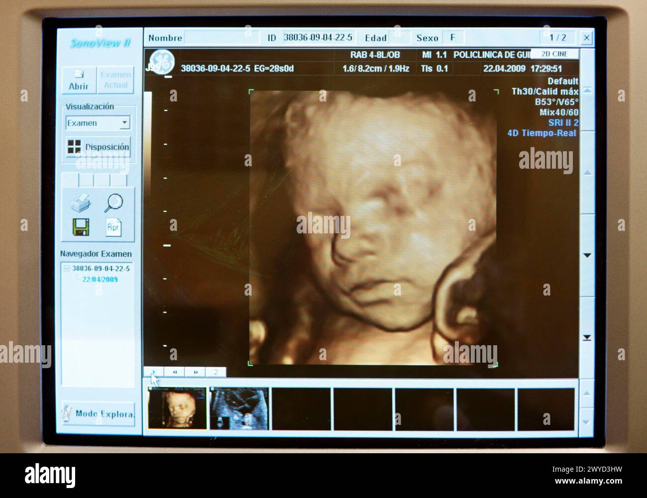 Ultrasound scan baby colour hi-res stock photography and images - Alamy