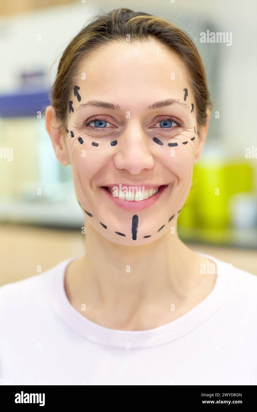 Facelift. Blepharoplasty. Rhytidoplasty. It involves stretching the ...