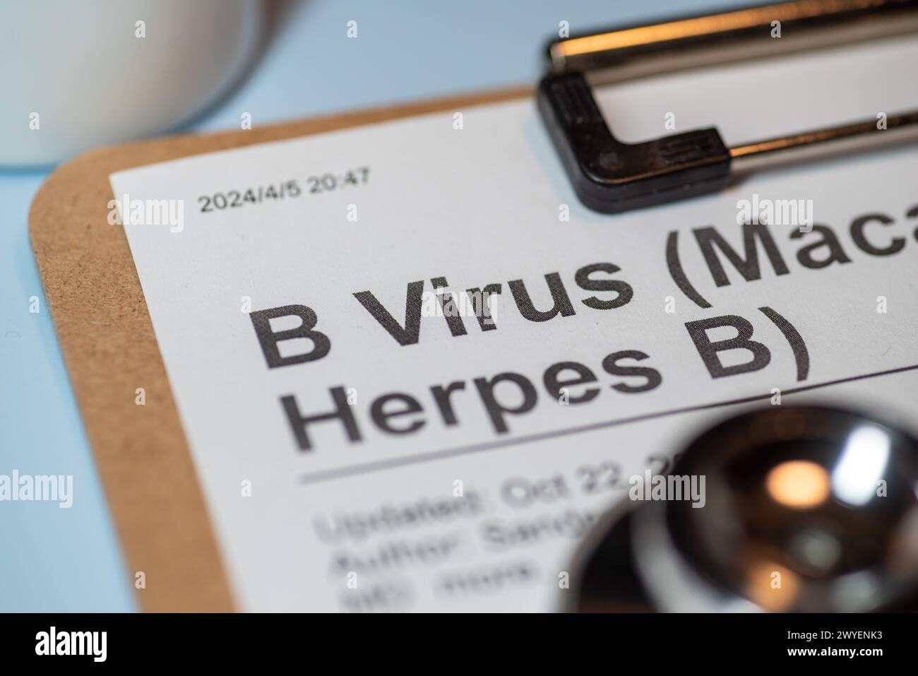Macacine alphaherpesvirus 1 hi-res stock photography and images - Alamy