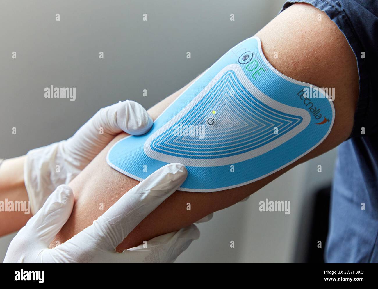 ELCODE, electrode-controlled transdermal drug delivery system based on ...