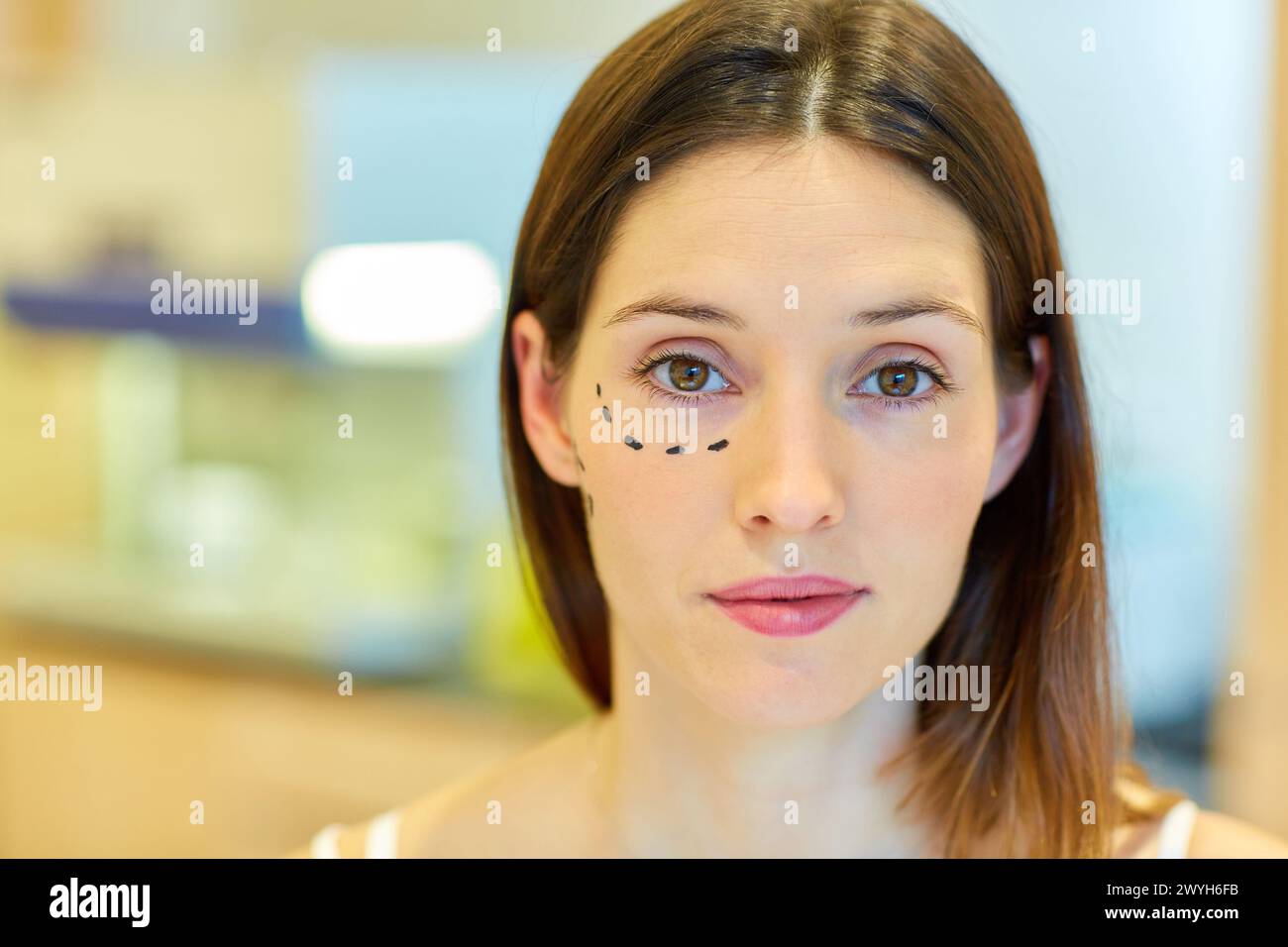 Facelift. Blepharoplasty. Surgery that aims to rejuvenate the look. It ...