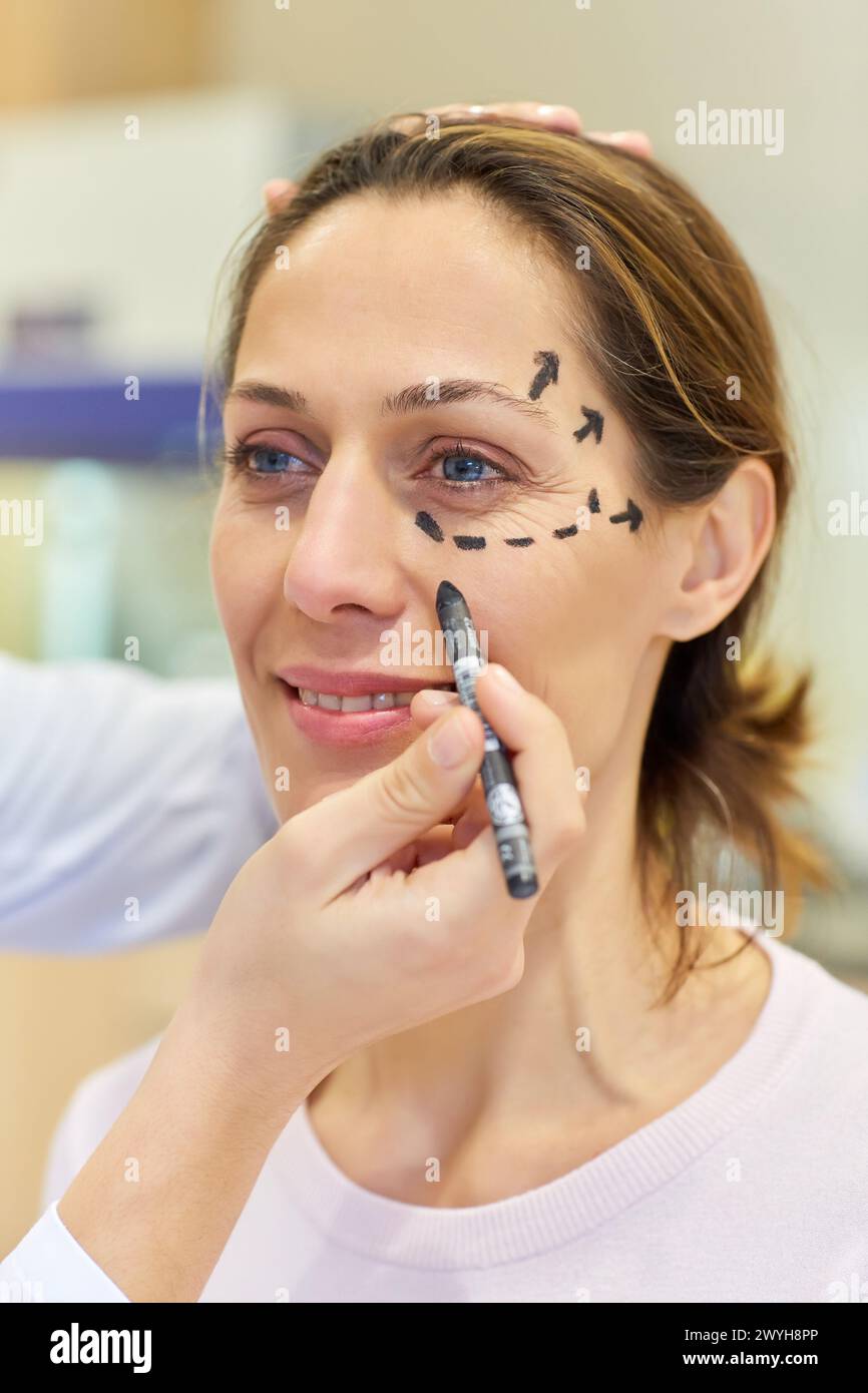 Facelift. Blepharoplasty. Rhytidoplasty. It involves stretching the ...