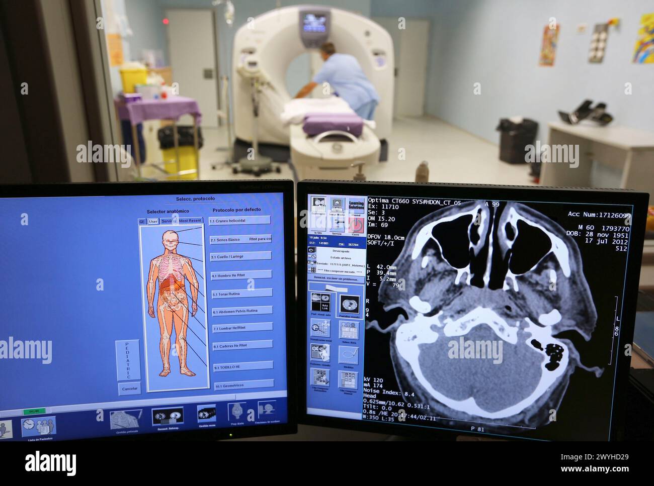 Radiology Interpretation Screen, CAT, Computarized Axial Tomography ...