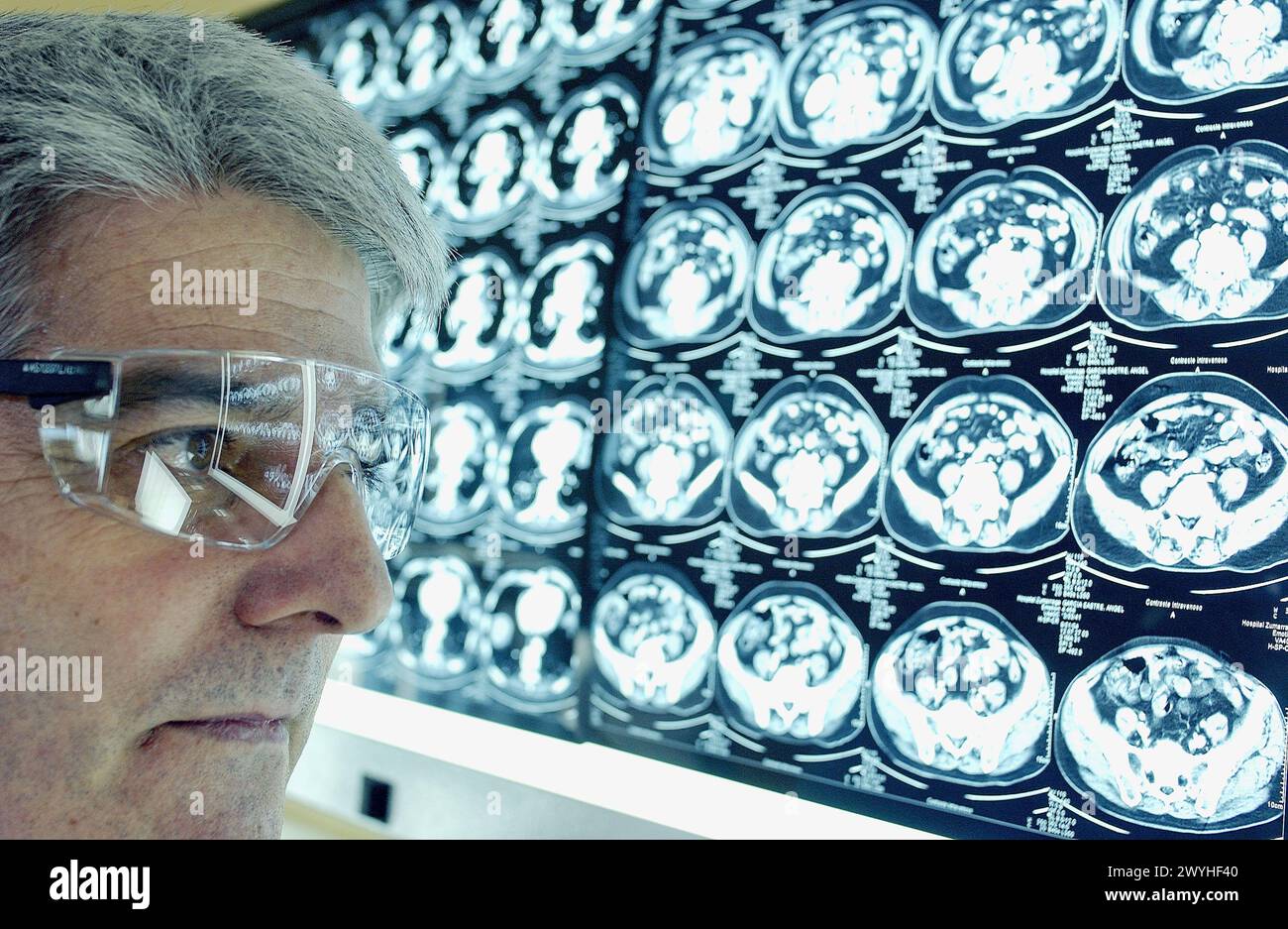 Medical imaging for diagnosis at hospital Stock Photo - Alamy