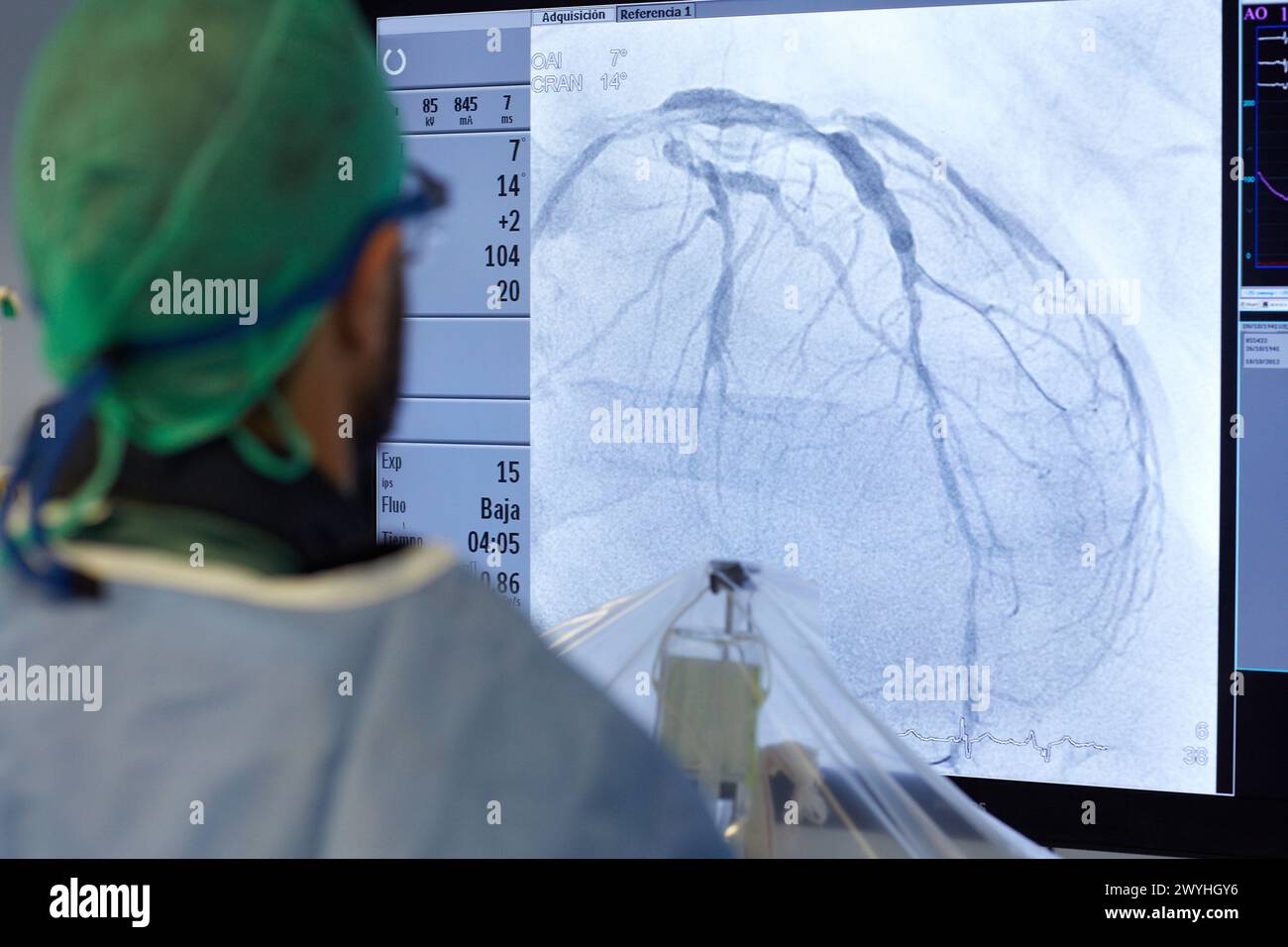 Angioplasty, Stenting in coronary arteries, Hemodynamic, Operating room ...
