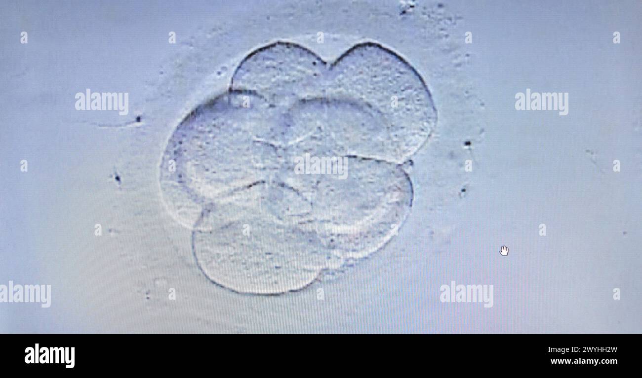 Embryo selection for IVF, URA, ARU, Assisted Reproduction Unit, In ...