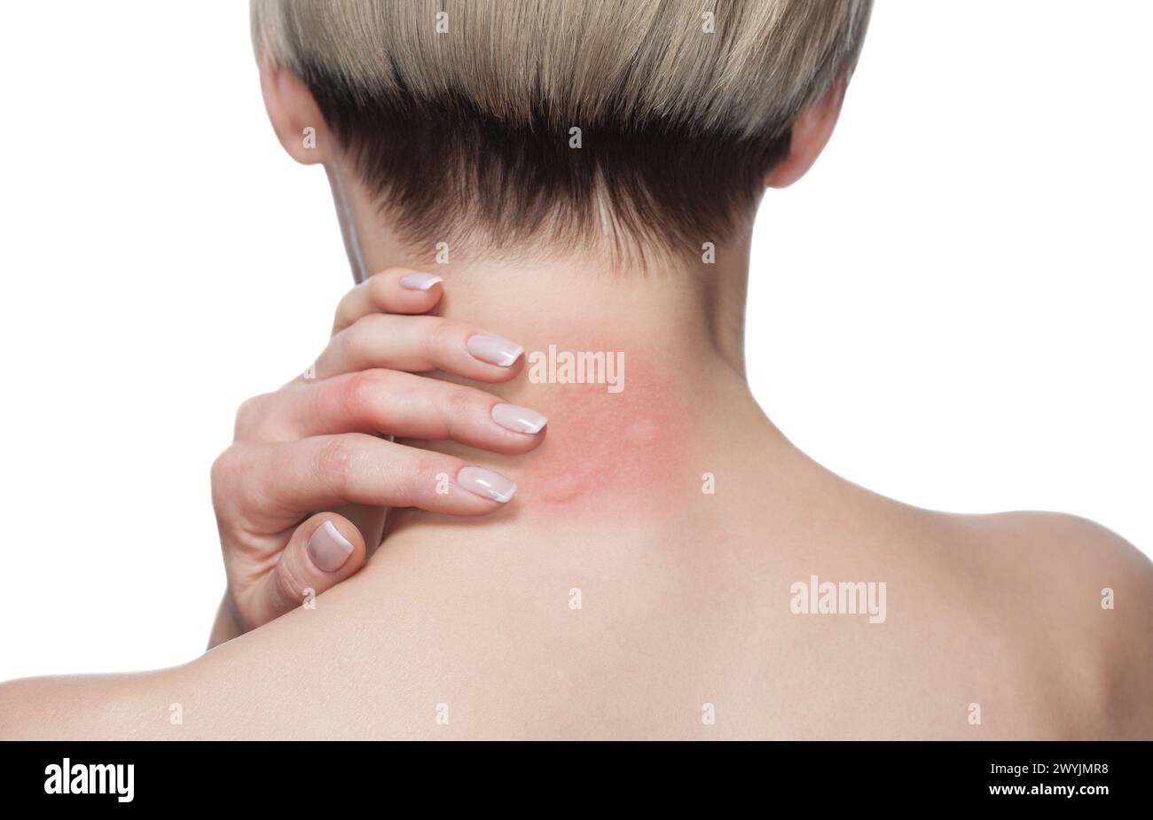 Girl with blond hair, sitting with his back turned and scratching ...