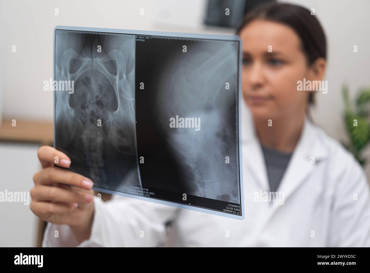 Radiological diagnostics hi-res stock photography and images - Alamy