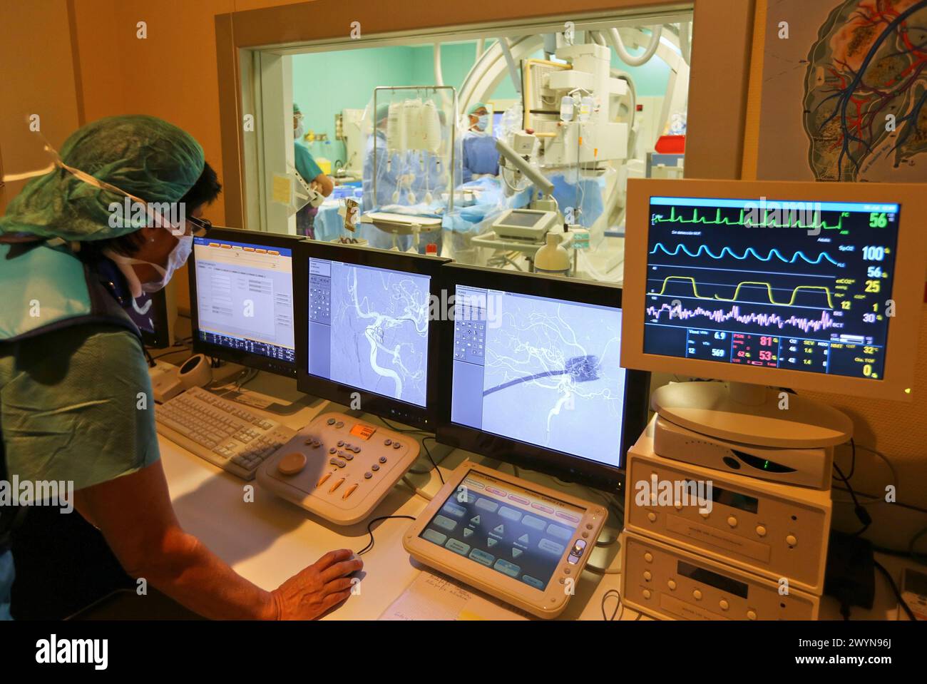 Cerebral aneurysm embolization, Willis polygone Angiography ...