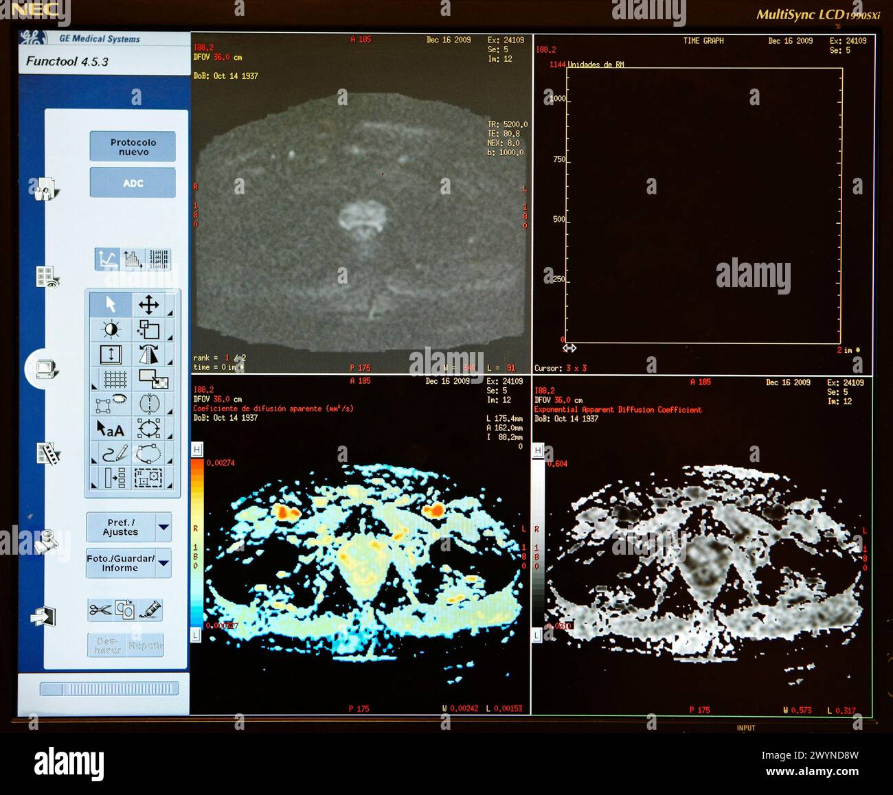 Hd scan hi-res stock photography and images - Alamy