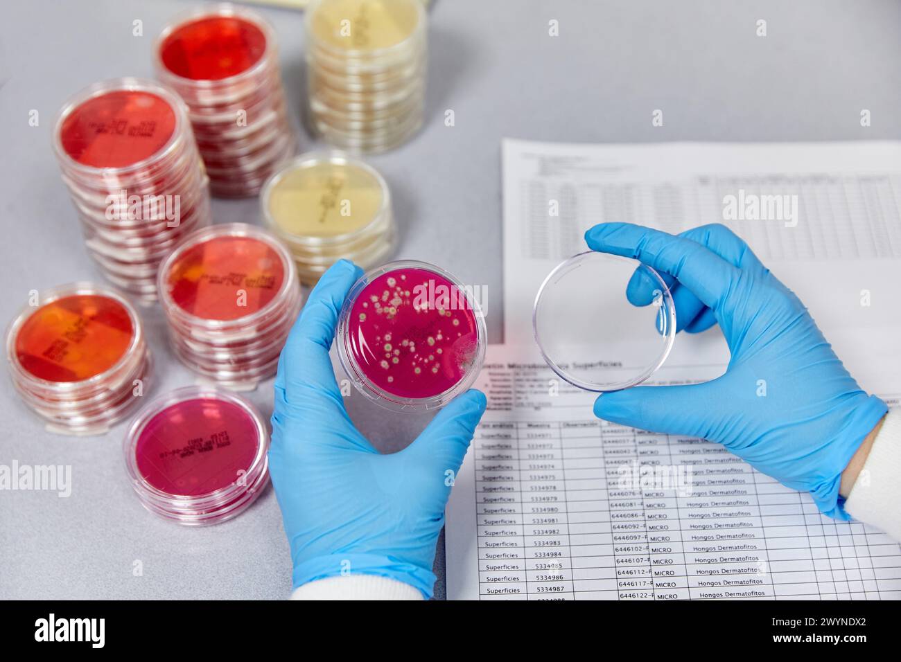 Laboratory Surface Analysis, Dermatophyte Fungi Stock Photo - Alamy