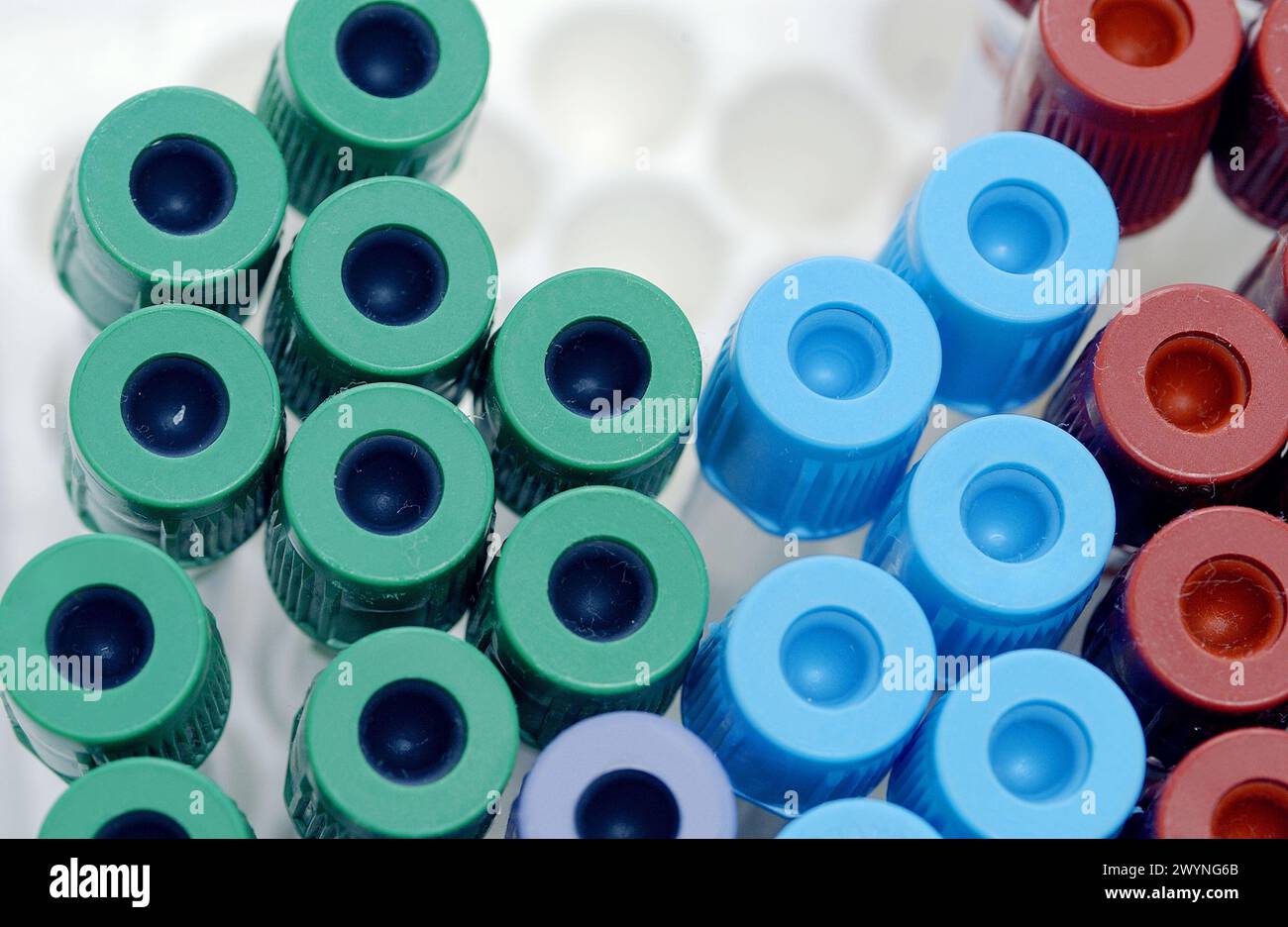 Blood sample tubes at laboratory of hospital Stock Photo - Alamy