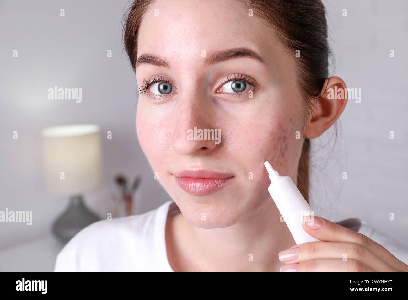 Woman blemish cream hi-res stock photography and images - Alamy