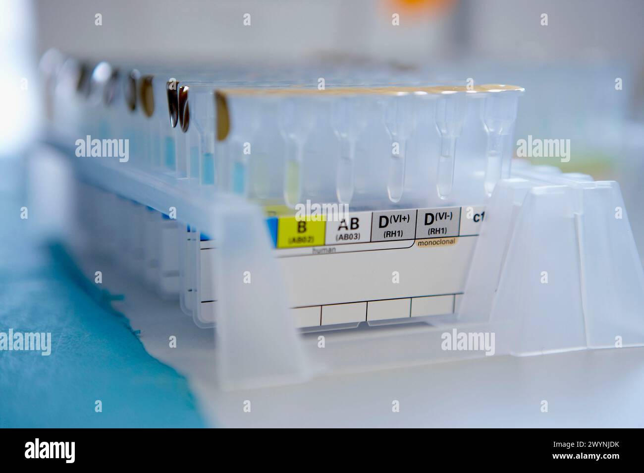 Samples, Cryogenics Laboratory, bone marrow bank. Hospital ...