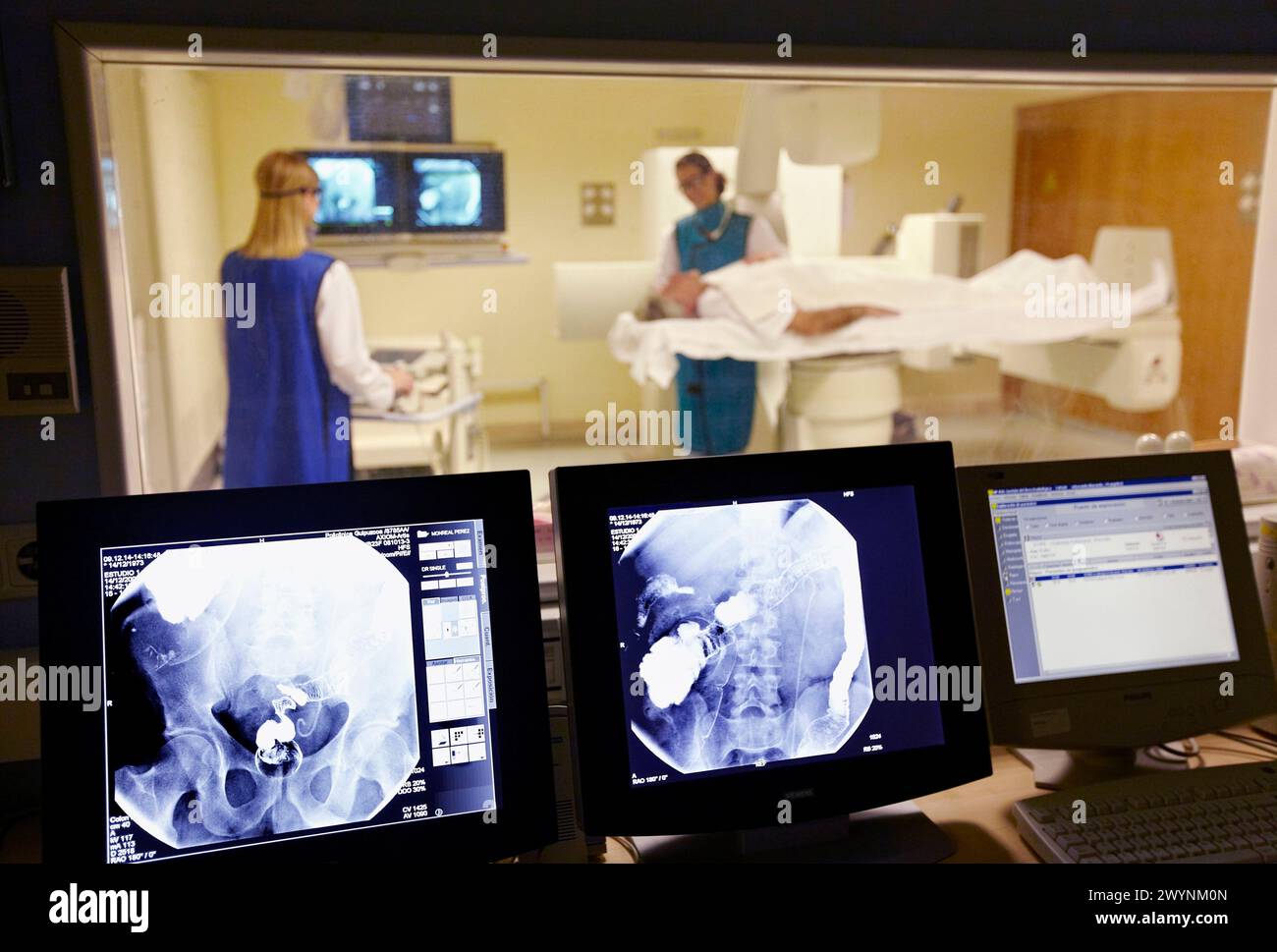 Contrast x-ray, digestive system, medical imaging for diagnosis ...