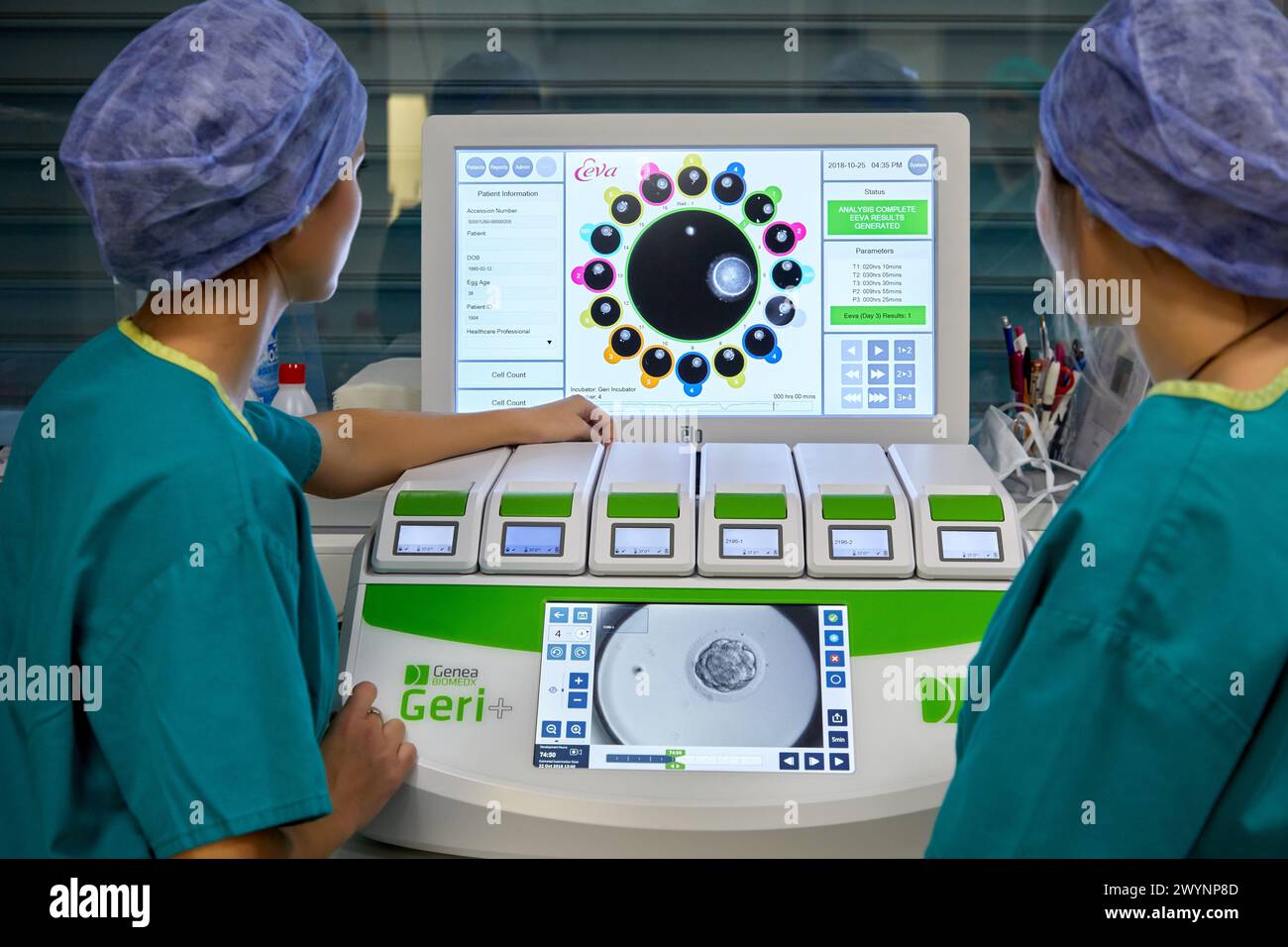 Geri +, EEVA System, Embryo Early Viability Assessment Test, Embryology ...