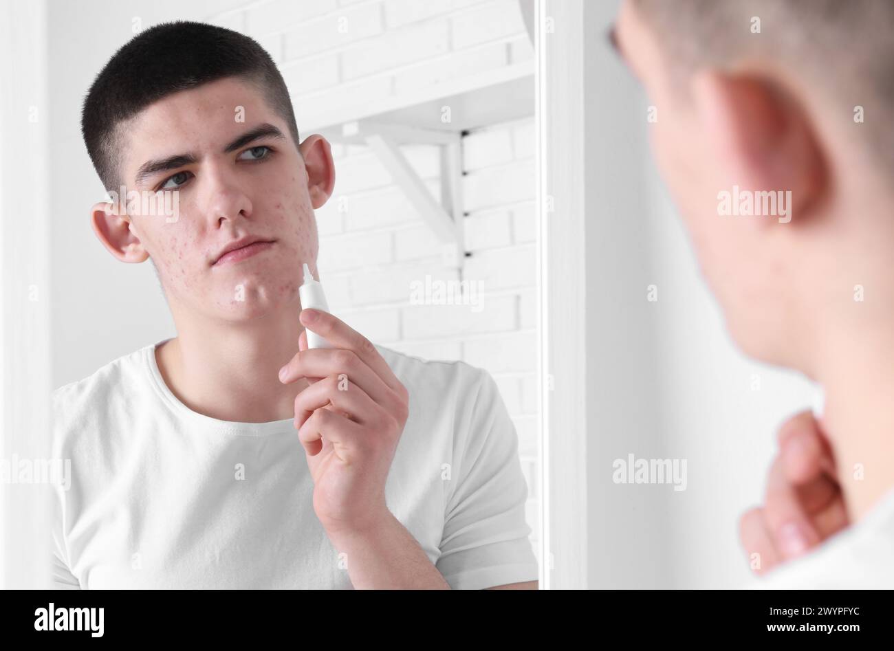 Man face problem skin hi-res stock photography and images - Alamy