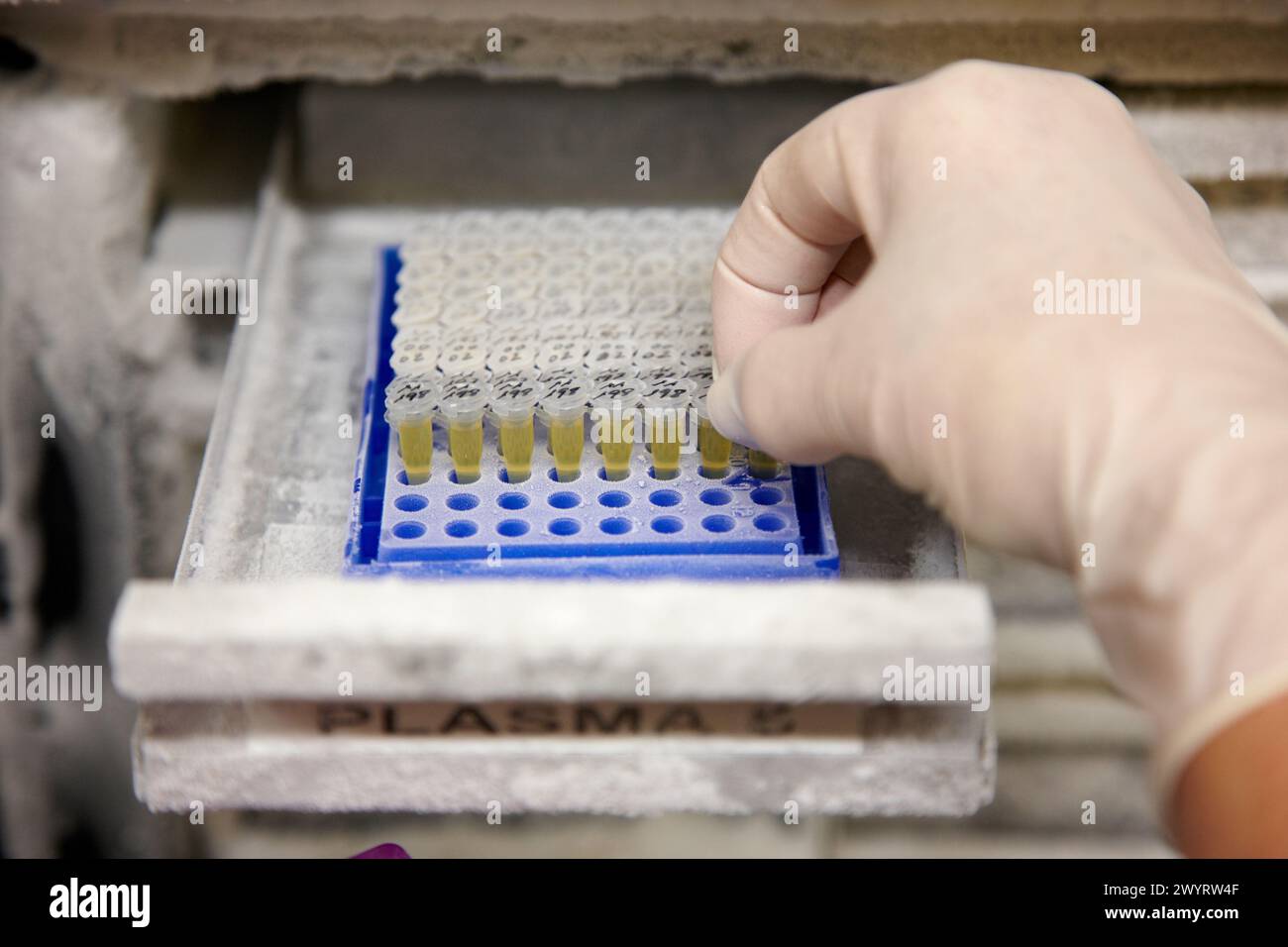 Frozen serum aliquots, stored samples in refrigerator at -80º C, DNA ...
