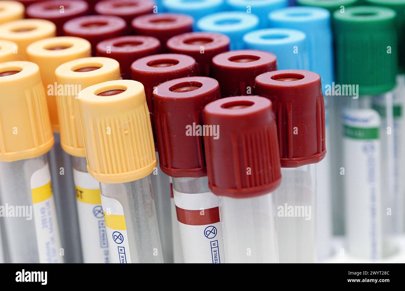 Blood sample tubes at laboratory of hospital Stock Photo - Alamy