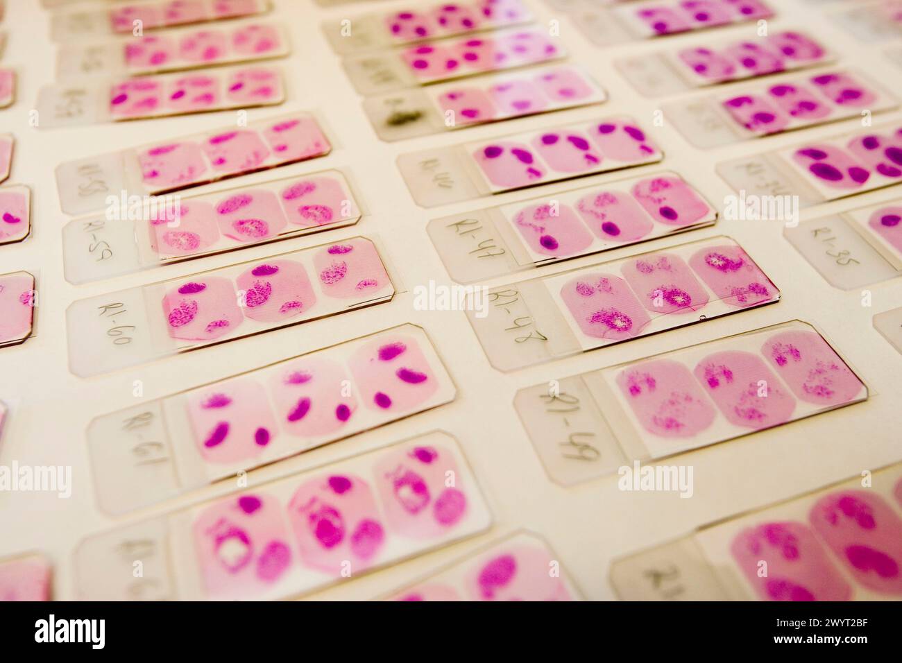 Fishing biology laboratory. Polishing and reading of otoliths and ...