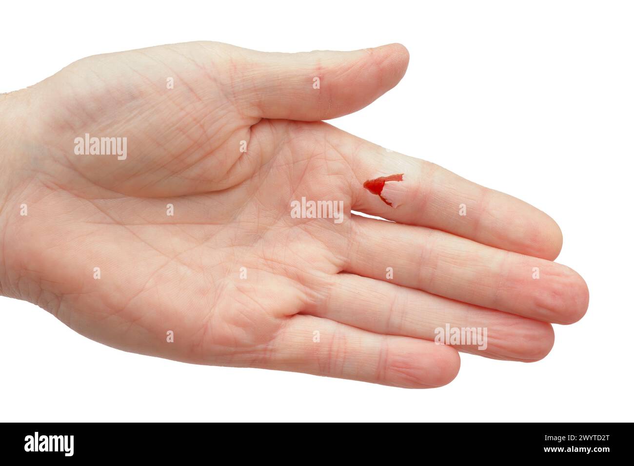 Finger cut and hand hi-res stock photography and images - Alamy