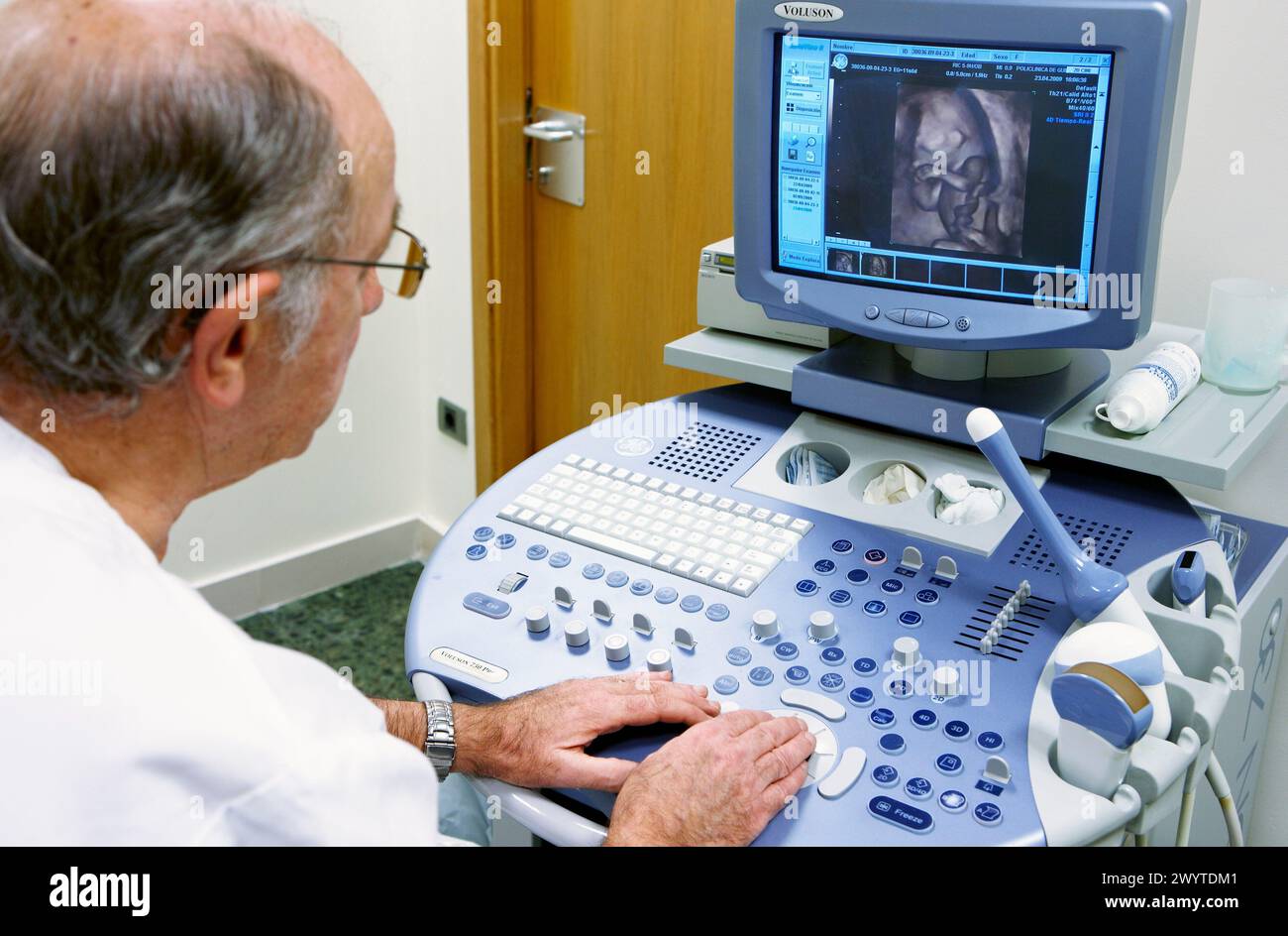 3D obstetric ultrasound of a fetus, 4D baby scan showing movement ...