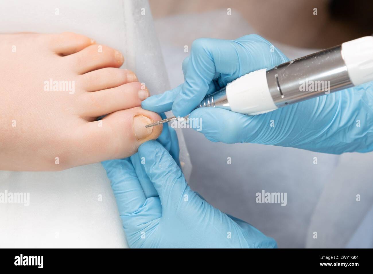 Podologist doing hardware pedicure with cutting mill Stock Photo - Alamy
