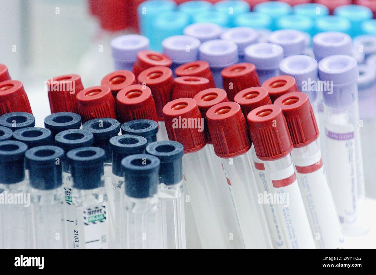 Blood sample tubes at laboratory of hospital Stock Photo - Alamy