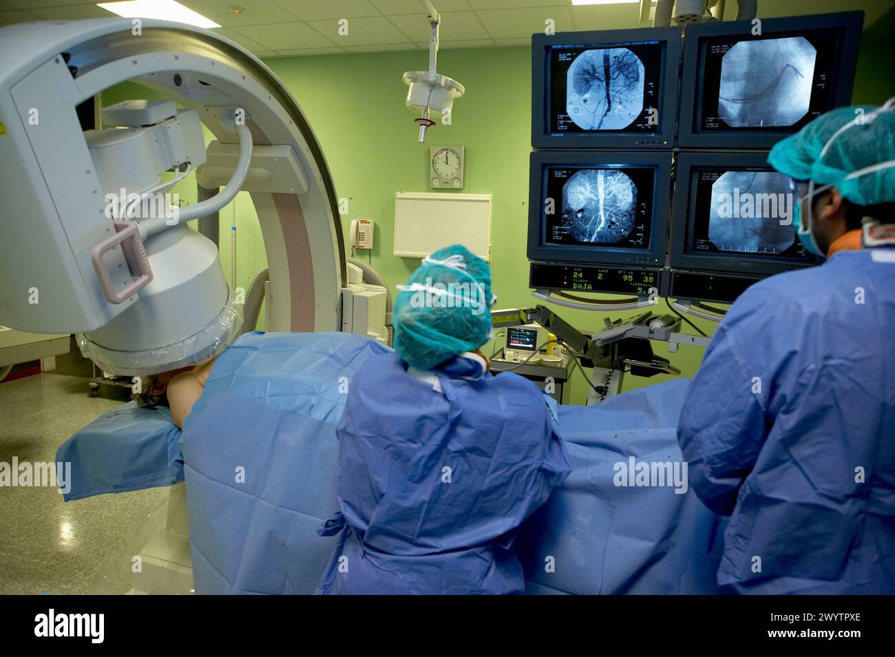 Supra aortic trunk hi-res stock photography and images - Alamy