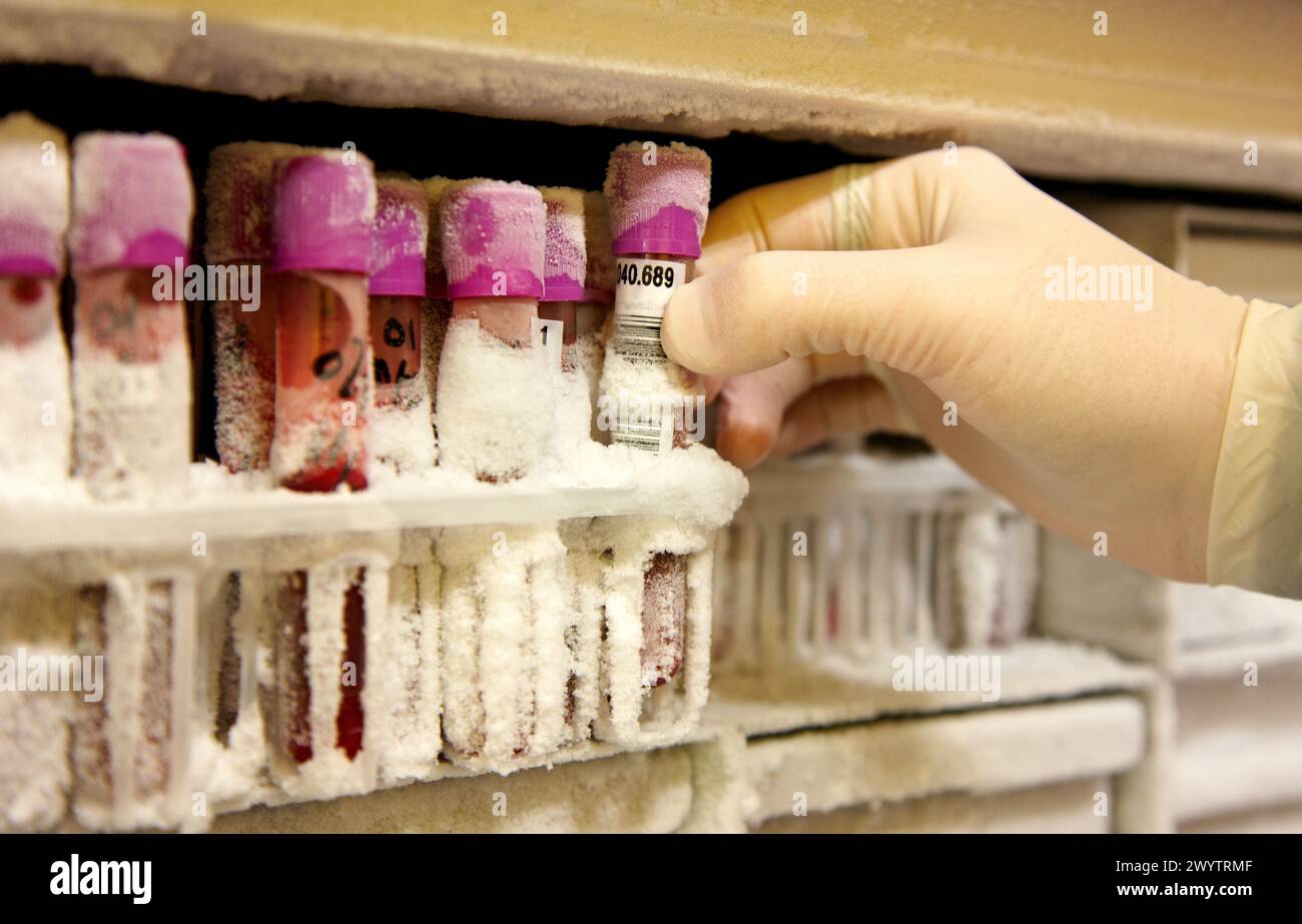 Frozen blood samples, stored samples in refrigerator at -80º C, DNA and ...
