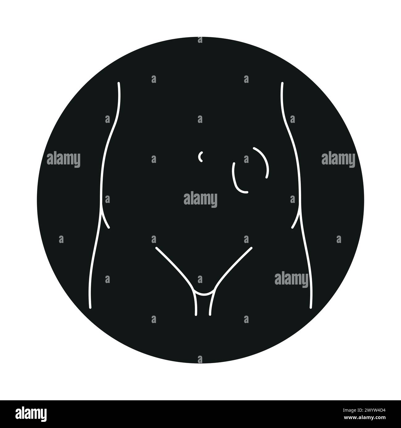 Inguinal hernia Stock Vector Images - Alamy