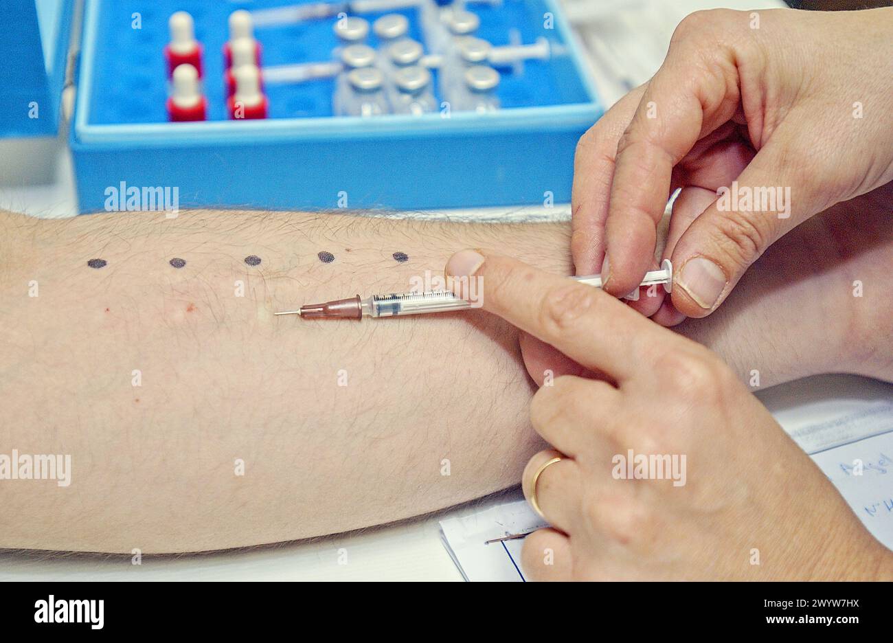 Allergy testing at hospital Stock Photo - Alamy