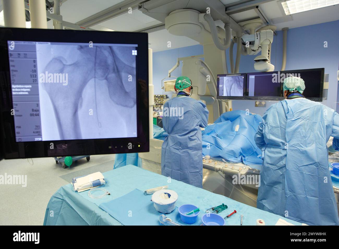 Angioplasty Distal, Vascular Interventional Radiology, Operating Room ...