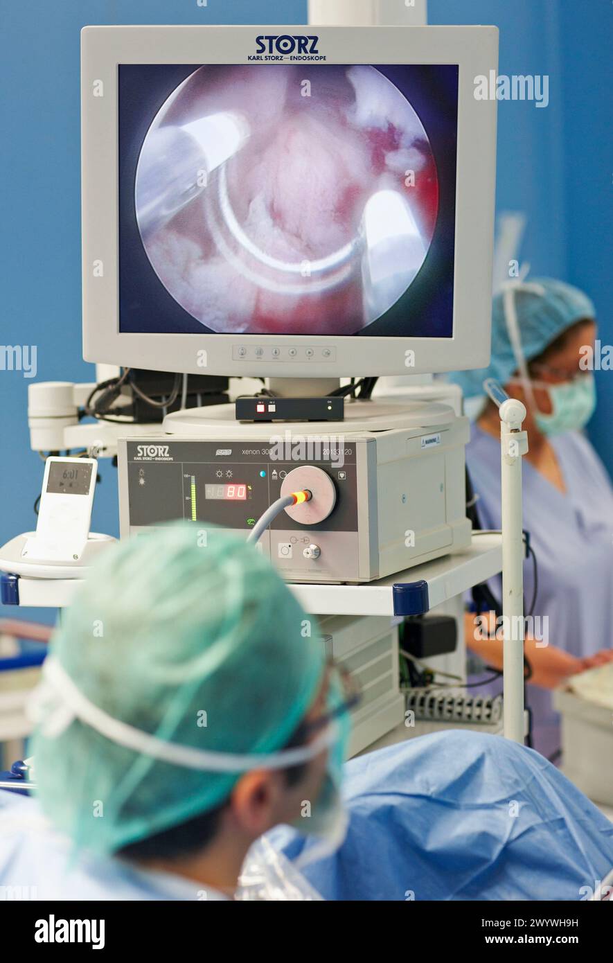 Transurethral resection hi-res stock photography and images - Alamy