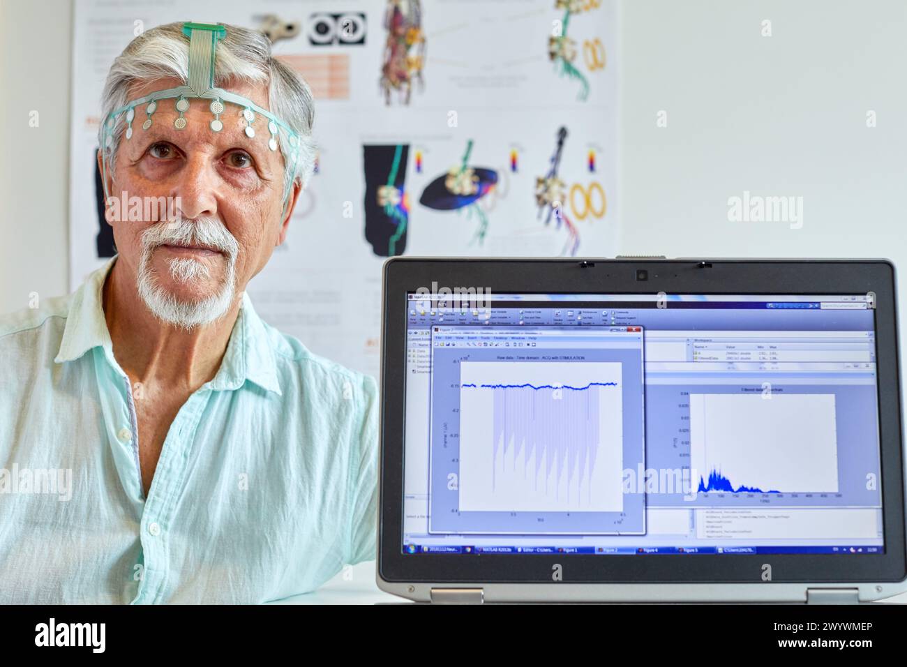 Neuromodulation system in closed loop hi-res stock photography and ...