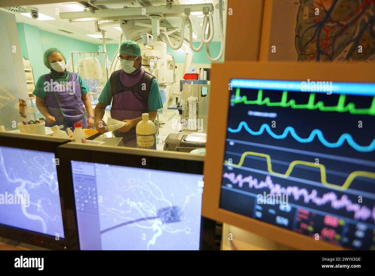 Cerebral aneurysm embolization, Willis polygone Angiography, Monitoring ...