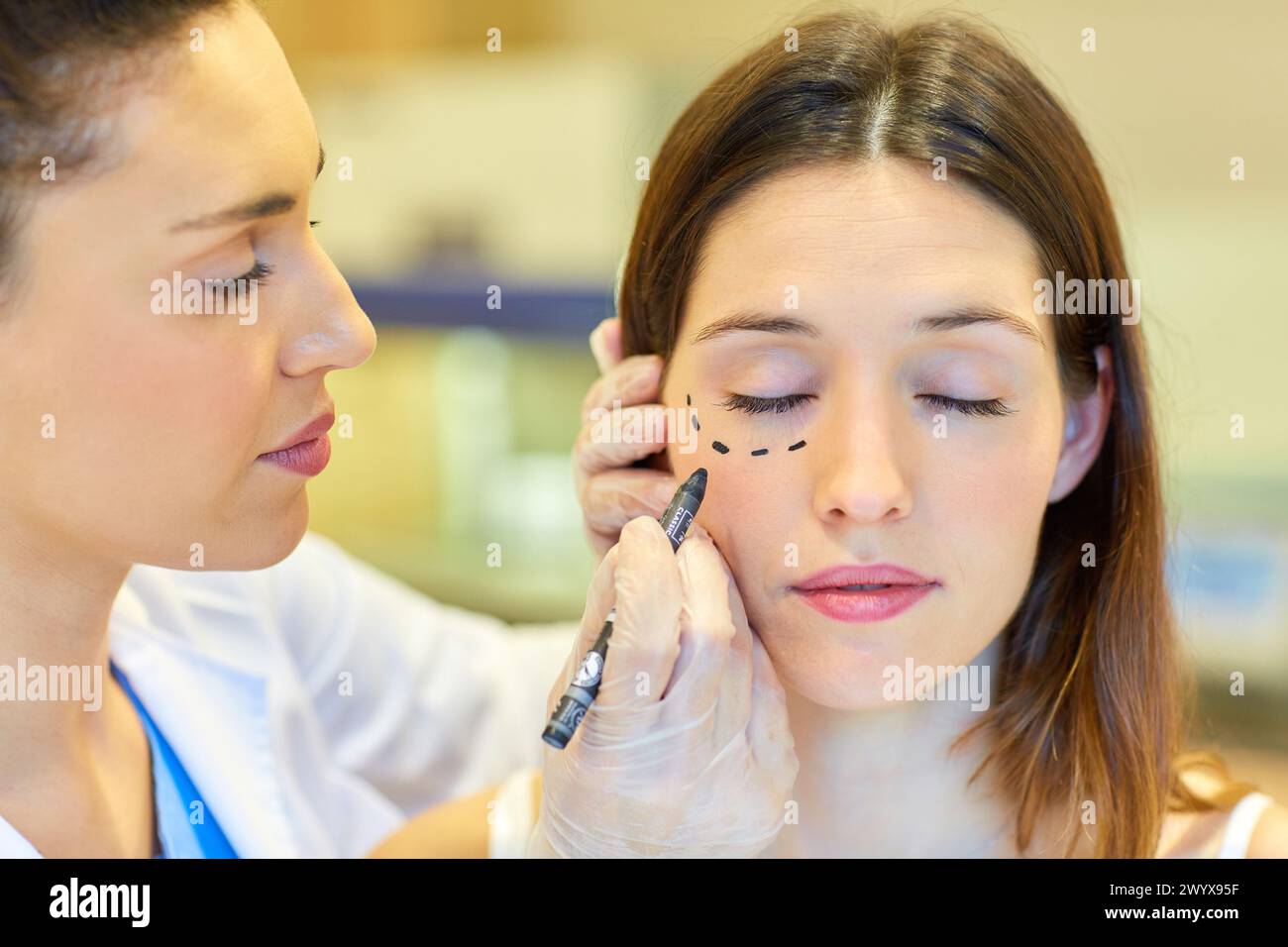 Facelift. Blepharoplasty. Surgery that aims to rejuvenate the look. It ...