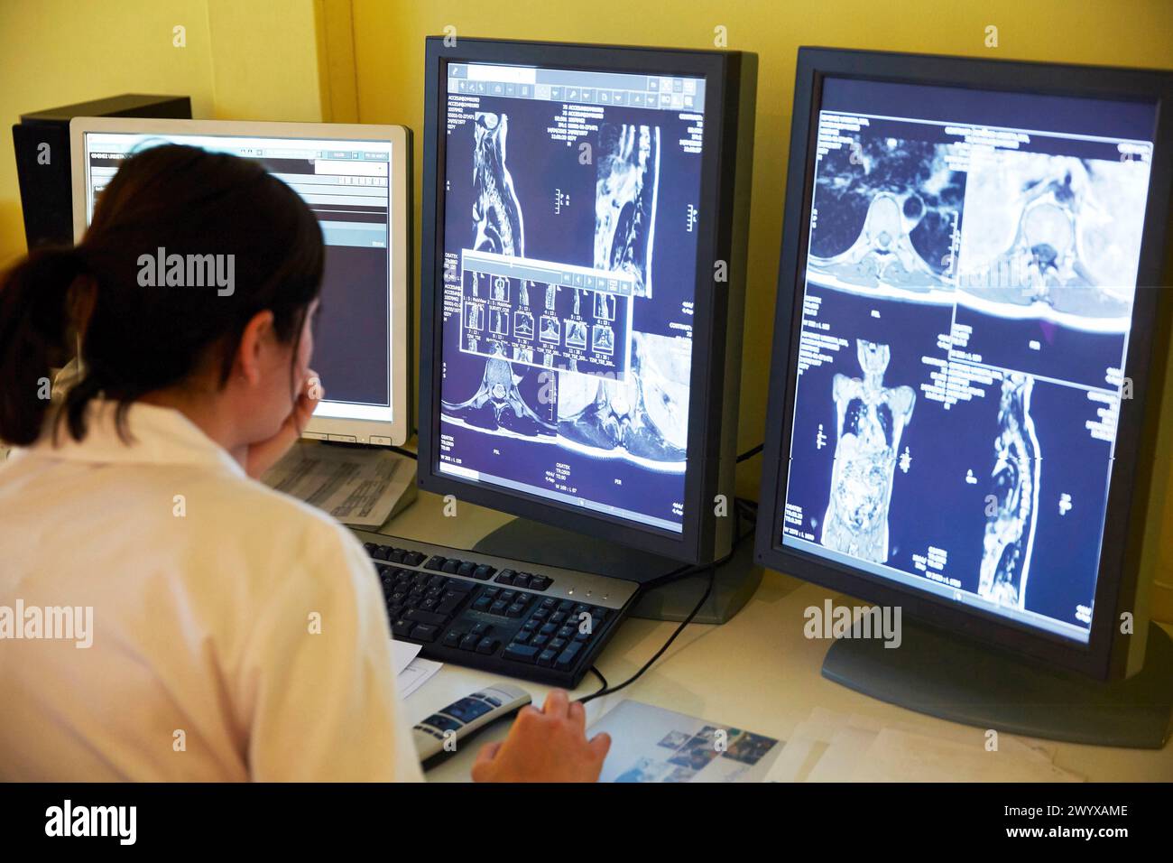 MRI scan, NMR (Nuclear Magnetic Resonance), medical imaging for ...