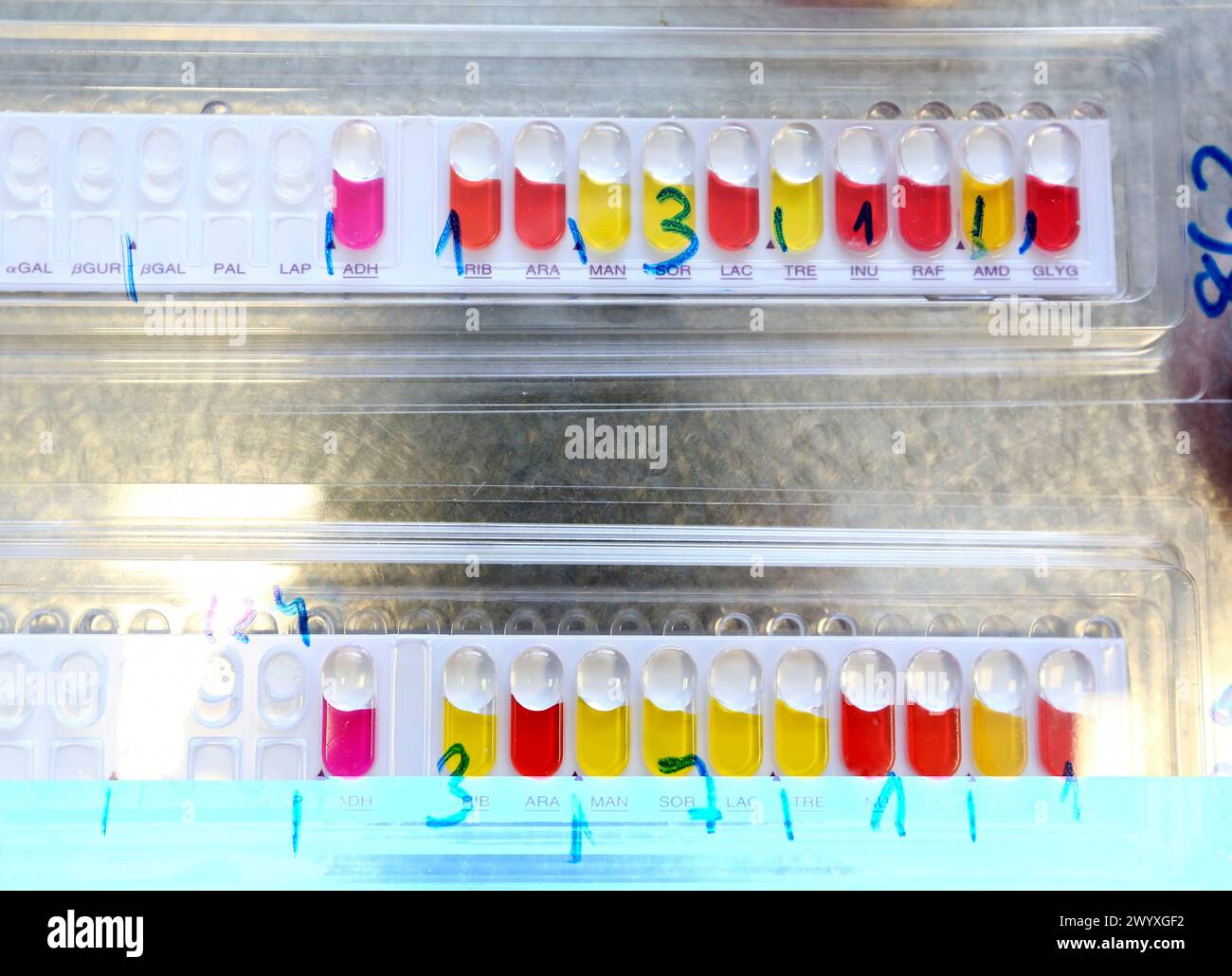 Biochemical test for bacteria hi-res stock photography and images - Alamy