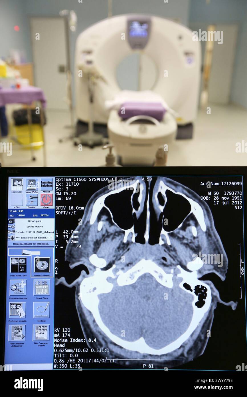 Brain scan interpretation hi-res stock photography and images - Alamy