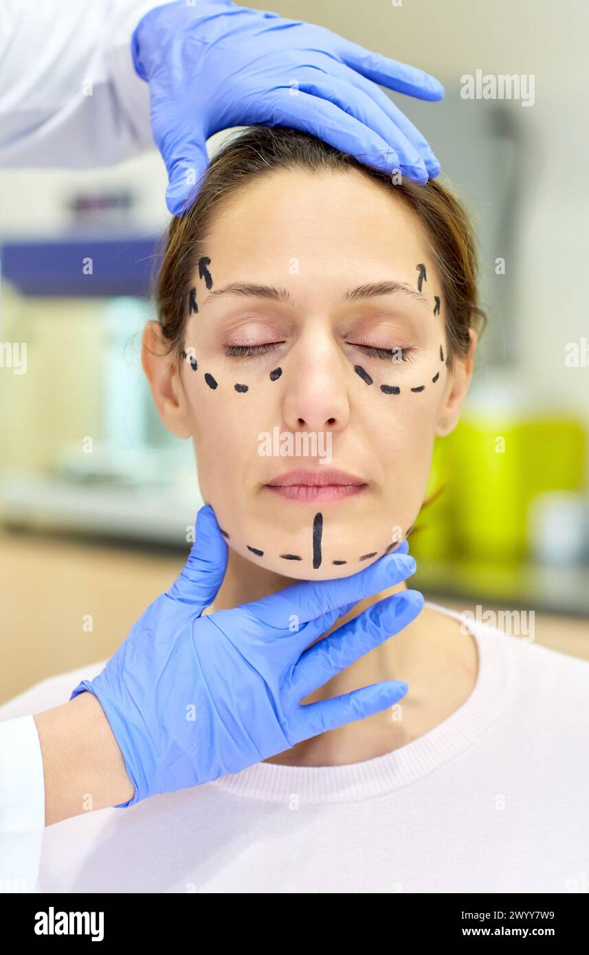 Facelift. Blepharoplasty. Rhytidoplasty. It involves stretching the ...