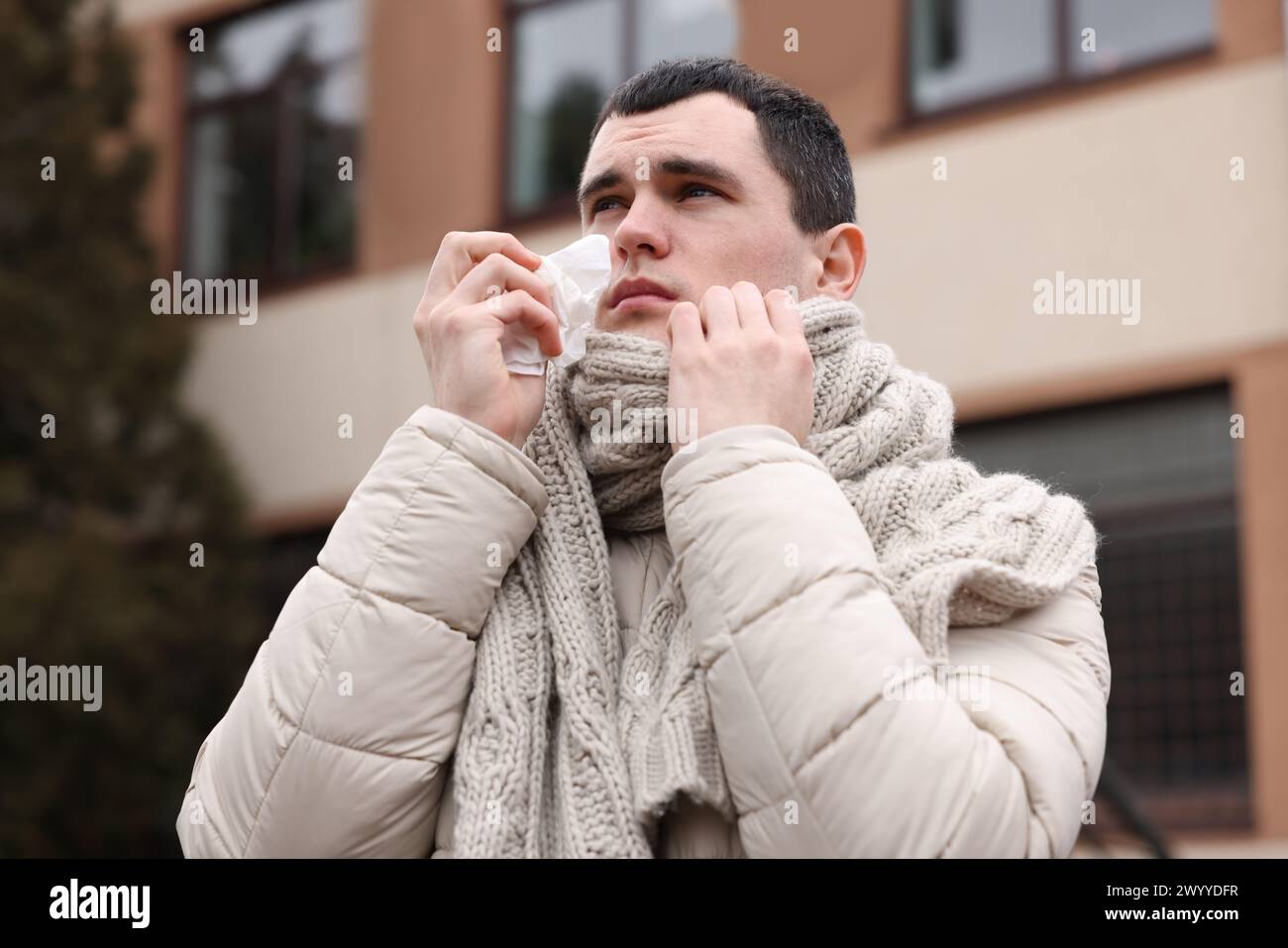 Sick young man with tissue on city street. Cold symptoms Stock Photo ...
