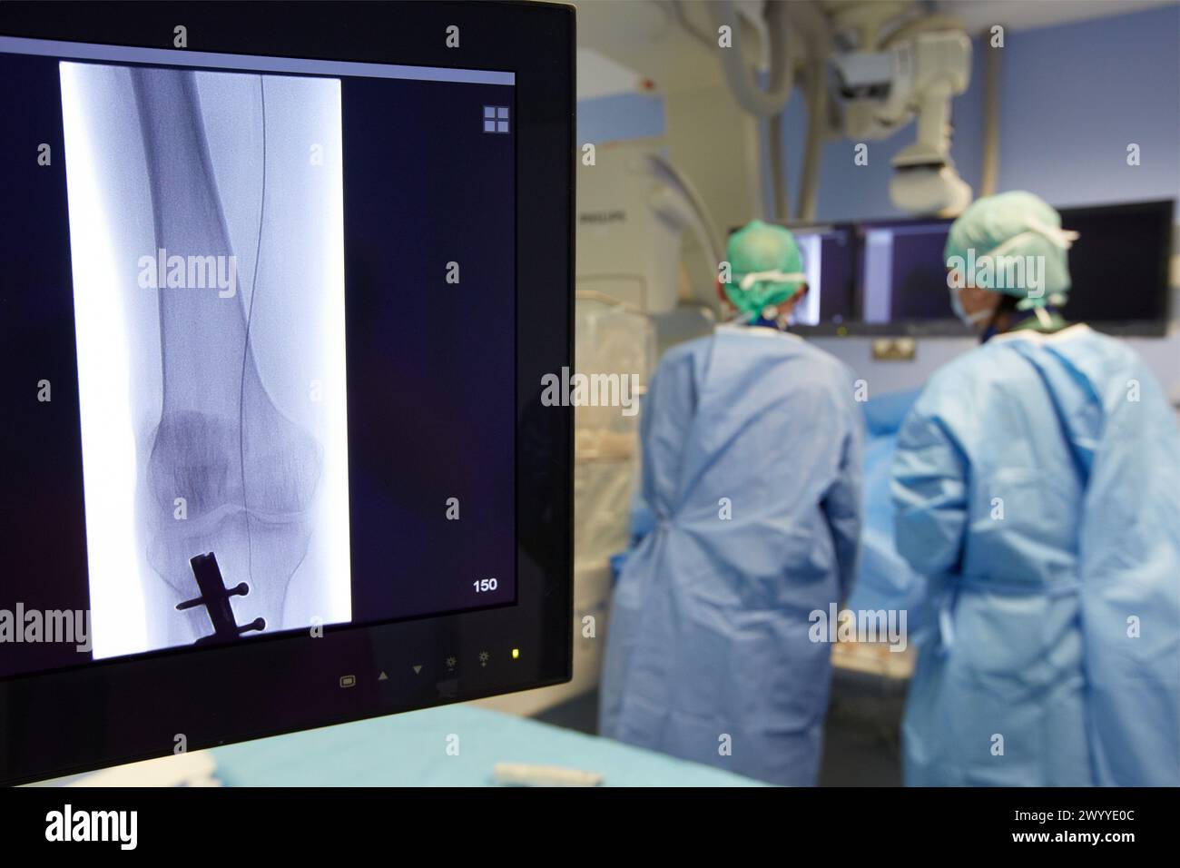 Angioplasty distal hi-res stock photography and images - Alamy