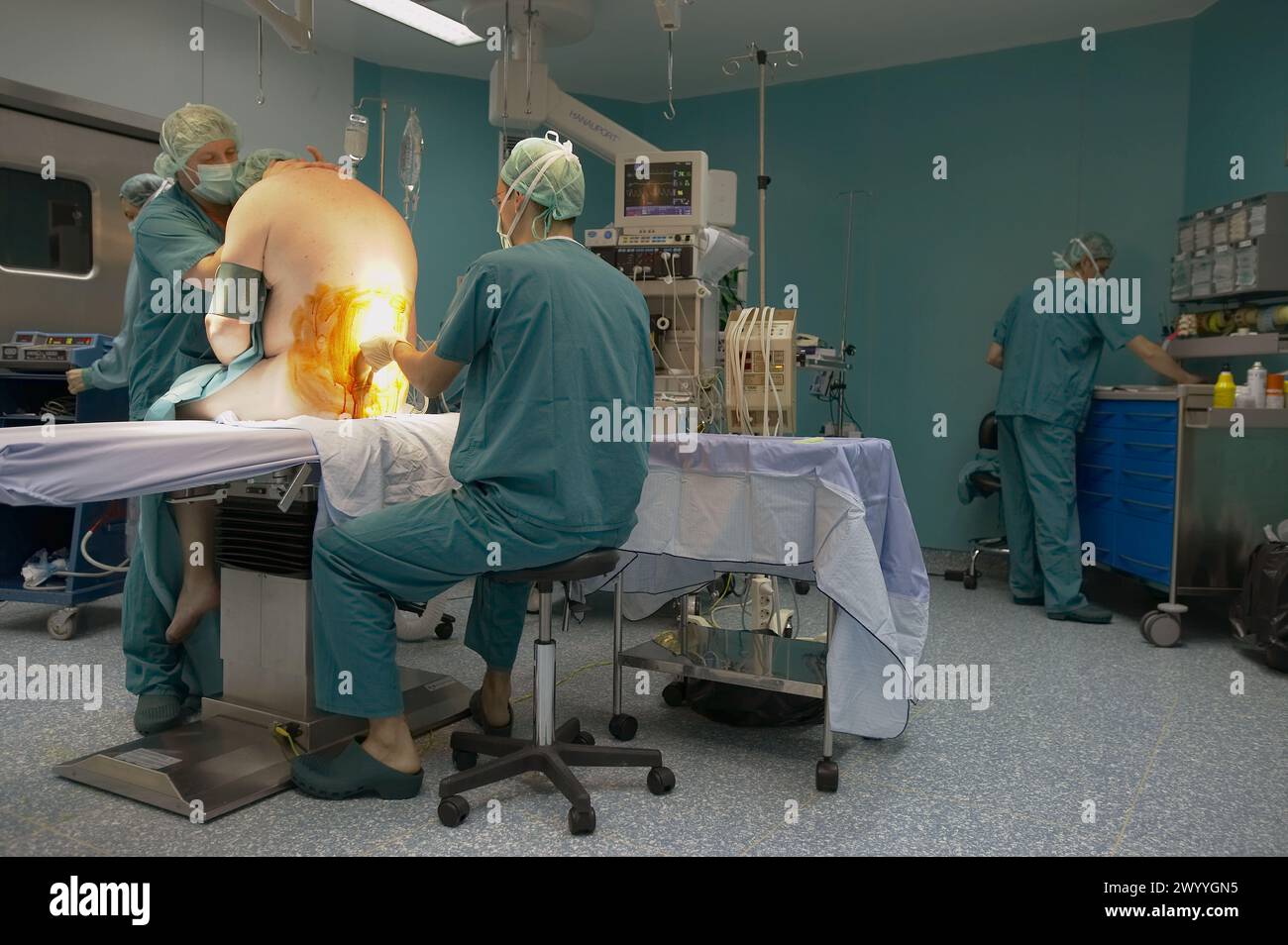 Epidural anesthesia, traumatology operation room. Hospital de Zumarraga ...